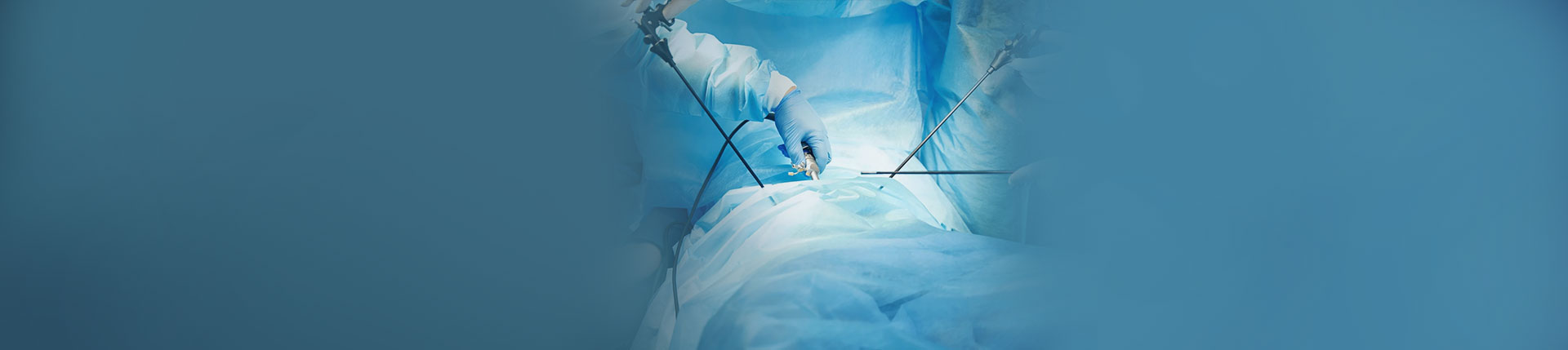 Laparoscopic surgeries - Royal Health Specialist One Day Surgery
